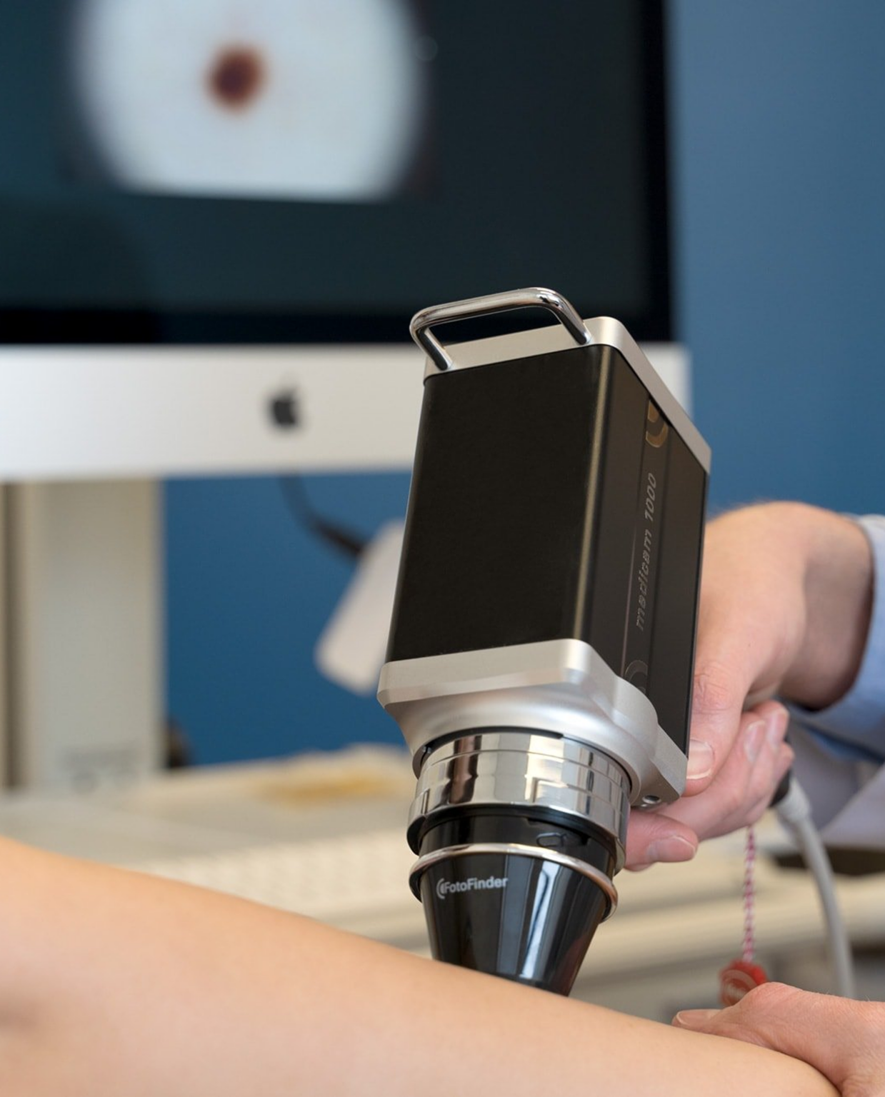 Mole Mapping - Xone Precision Medicine